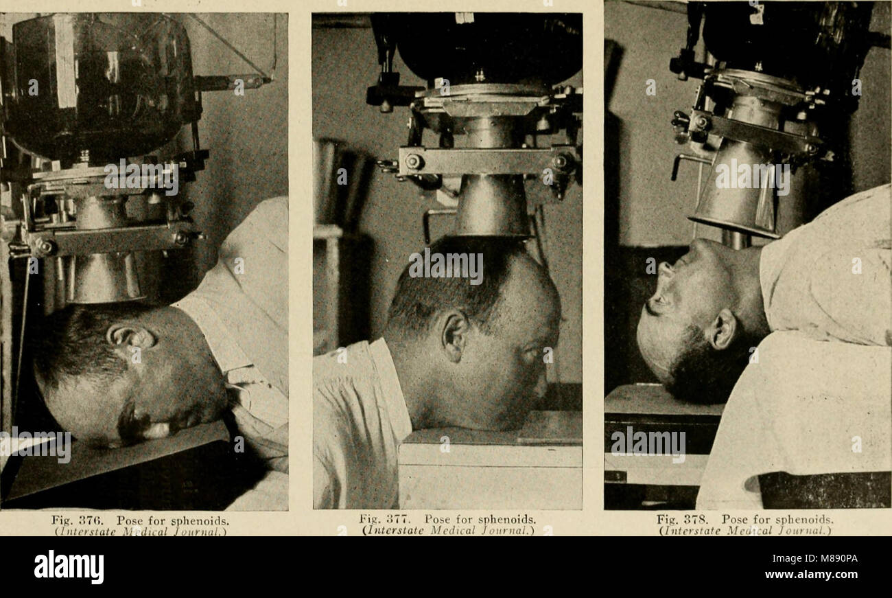 Elementary and dental radiography - by Howard Riley Raper (1918 ...