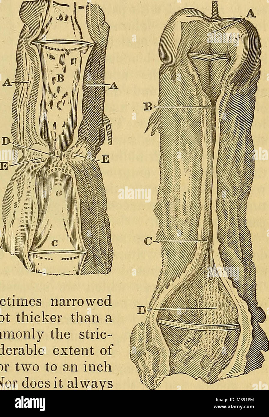 Elements of pathological anatomy (1843) (21075260020 Stock Photo - Alamy