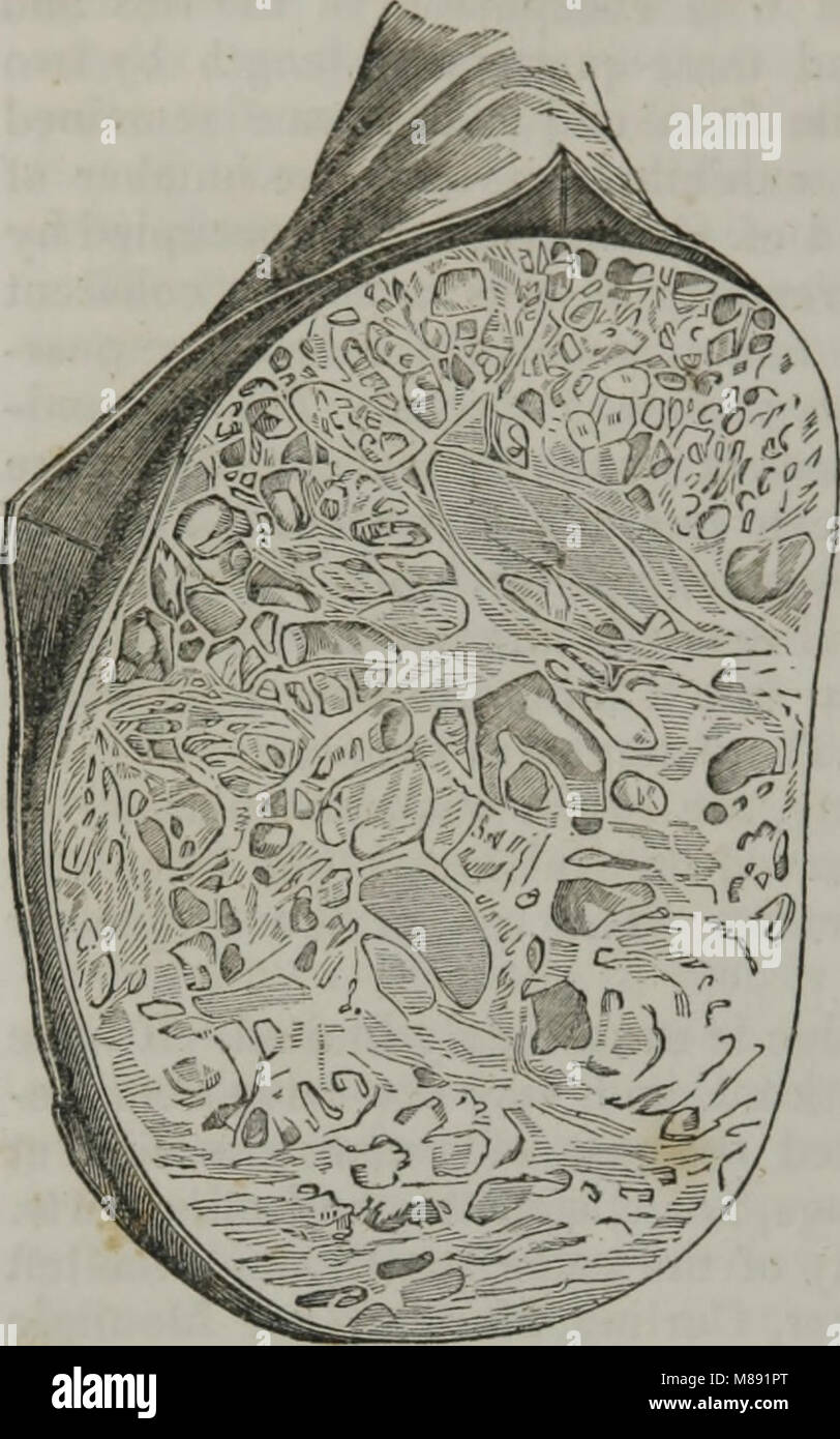 Elements of pathological anatomy (1845) (14596293410 Stock Photo - Alamy