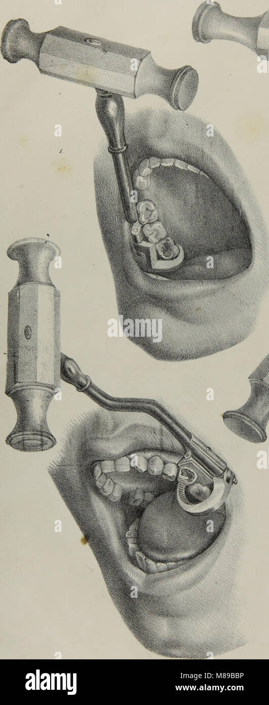'Extractions-3' (1844) explores the anatomy, physiology, and pathology ...