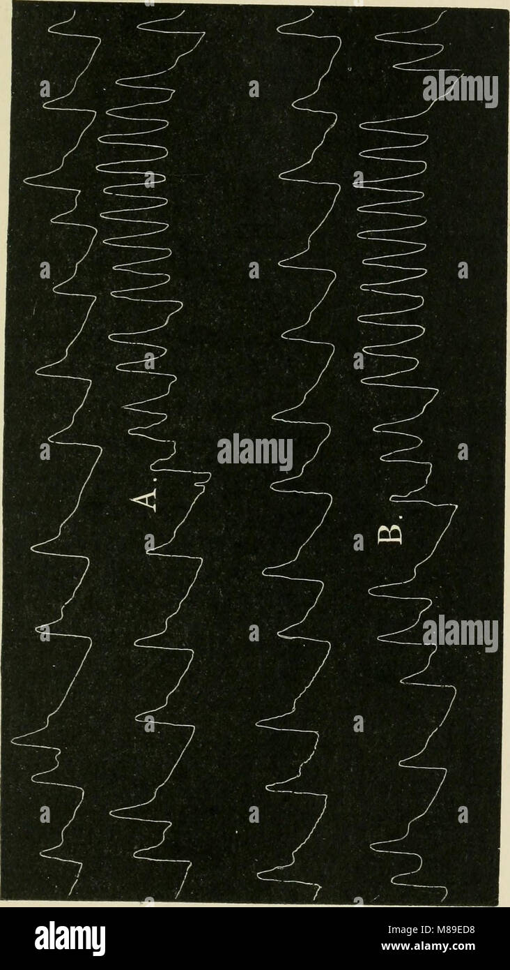'Fear' (1896) is a psychological exploration of fear, detailing its ...