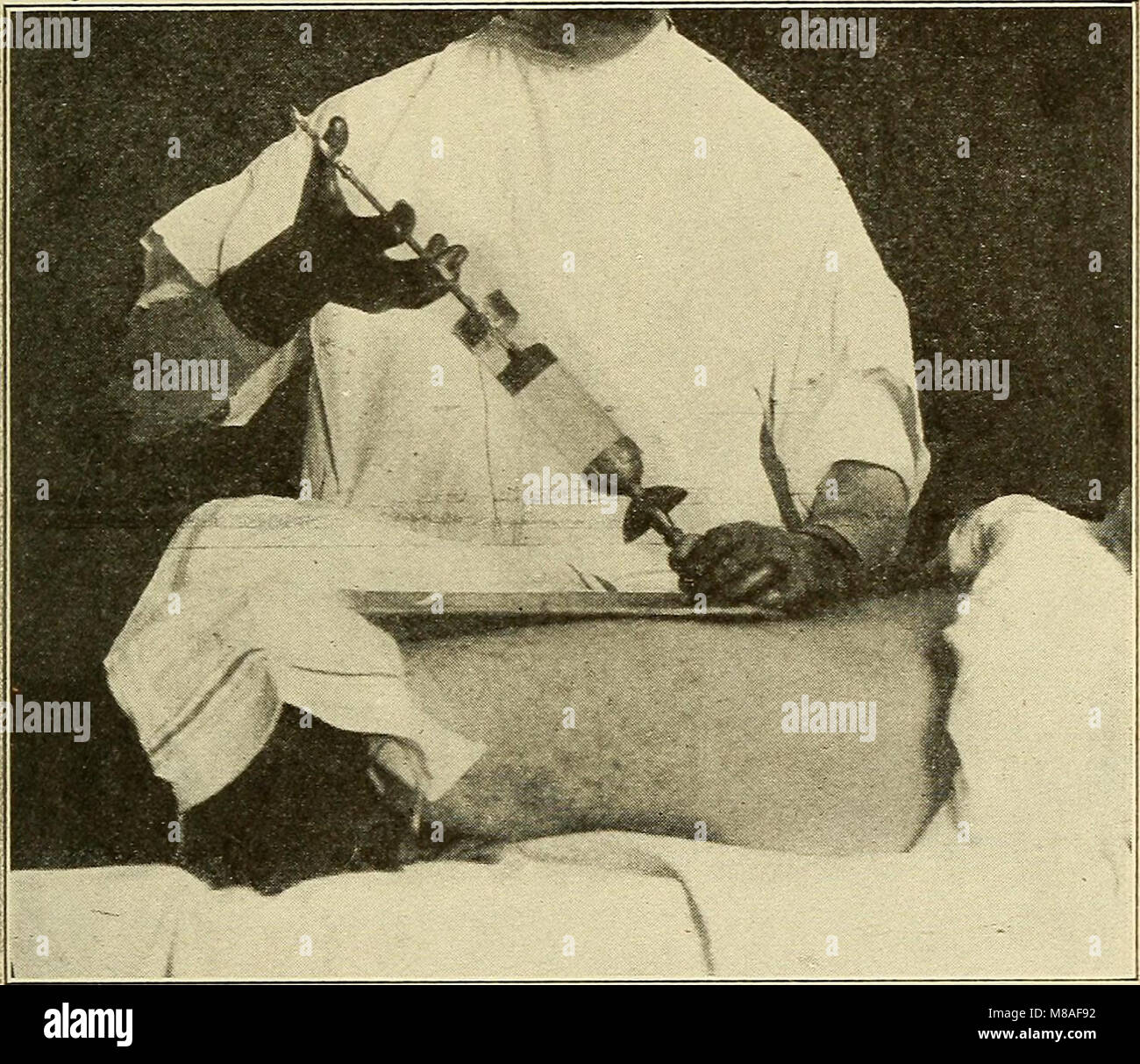 Gonorrhea male hi-res stock photography and images - Alamy