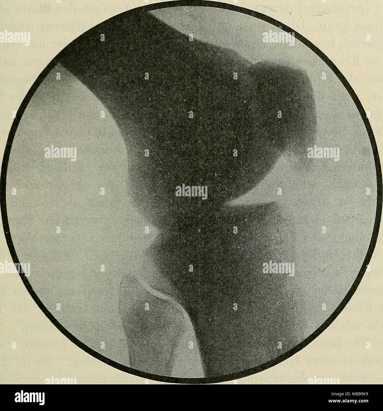 A 1906 German textbook on X-ray technology, providing detailed guidance ...