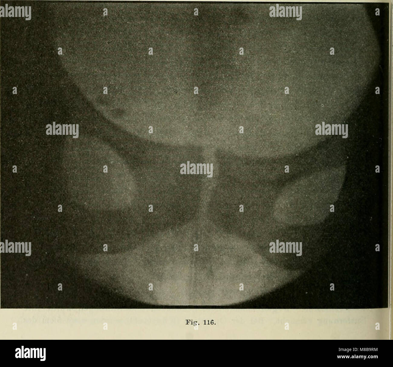 A 1906 textbook on radiology, specifically designed for doctors and ...