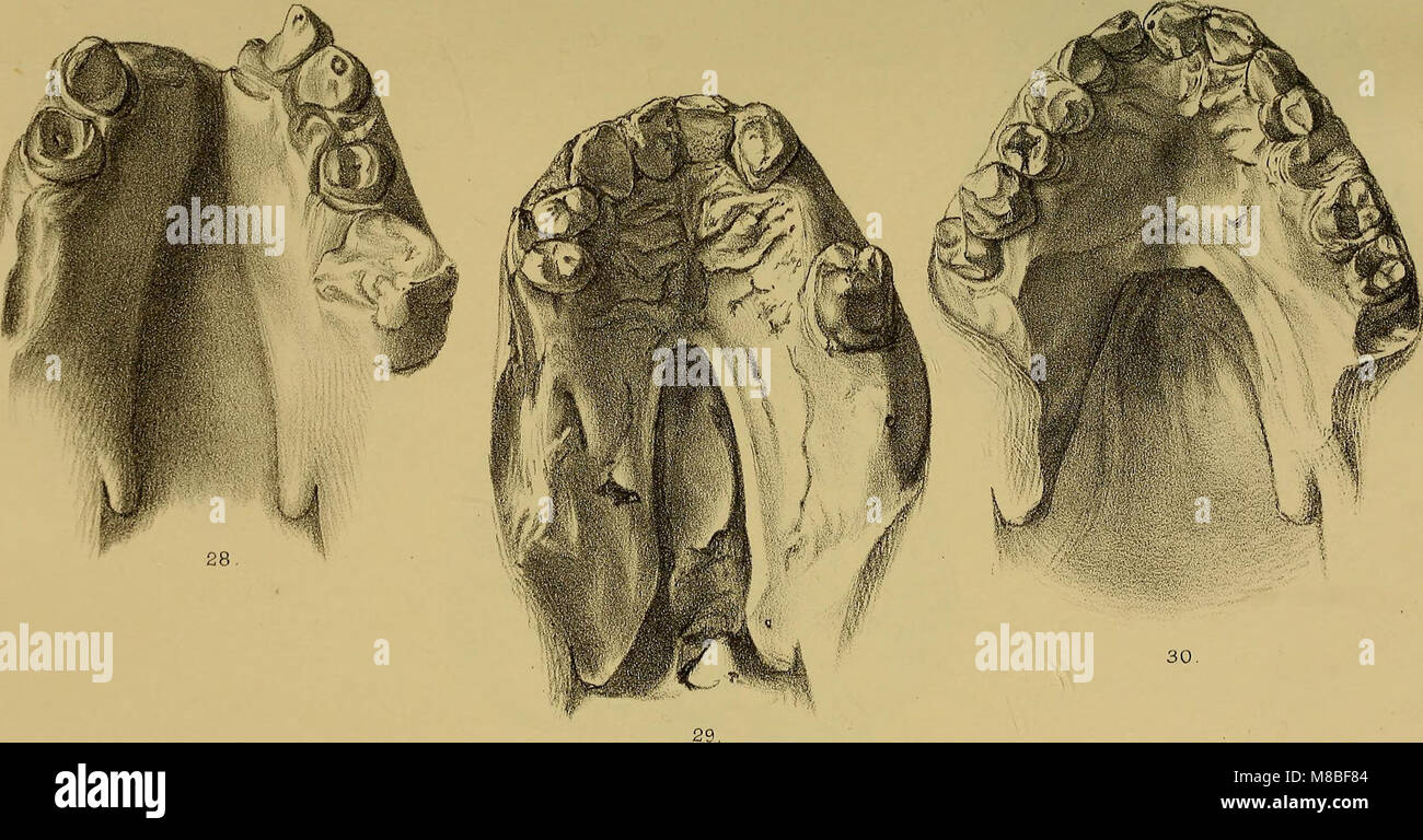 Deformities of the mouth - congenital and acquired, with their ...