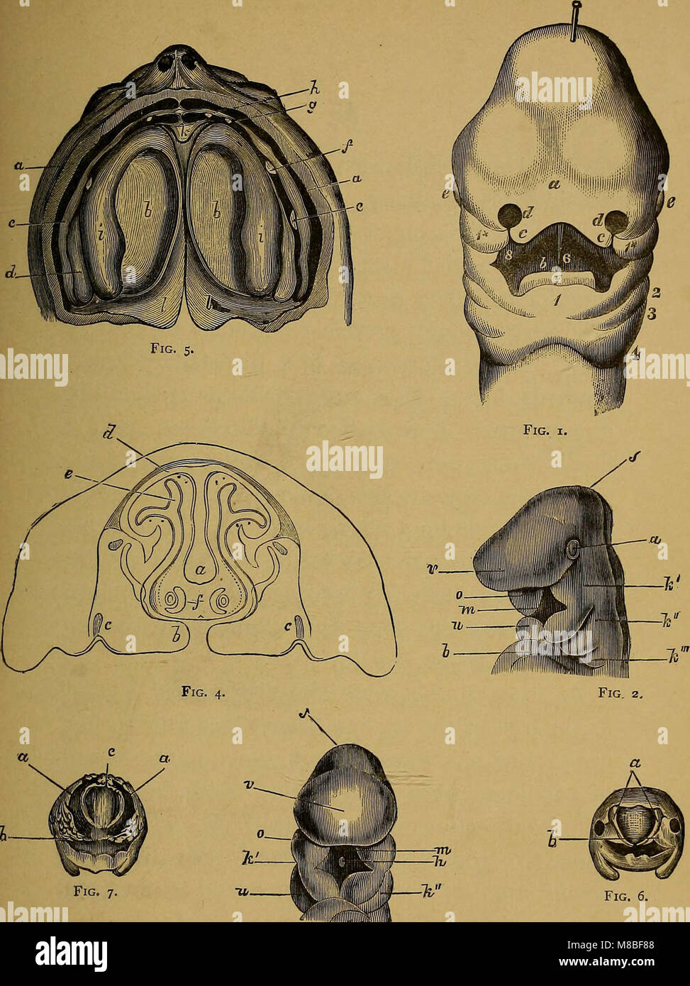 Deformity corrections hi-res stock photography and images - Alamy