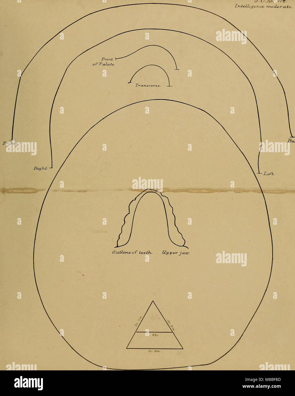 This 1881 medical work explores both congenital and acquired ...