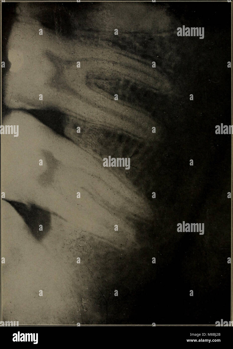 This 1913 publication on dental radiology explores the use of X-rays in ...