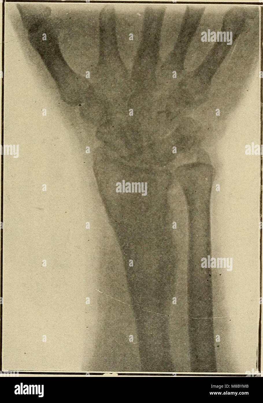Diseases of Bones and Joints (1914) focuses on medical conditions ...