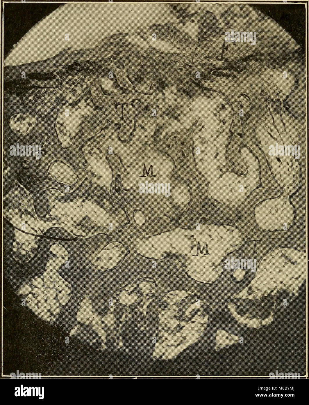 'Diseases of Bones and Joints' (1914) is a medical text that covers ...