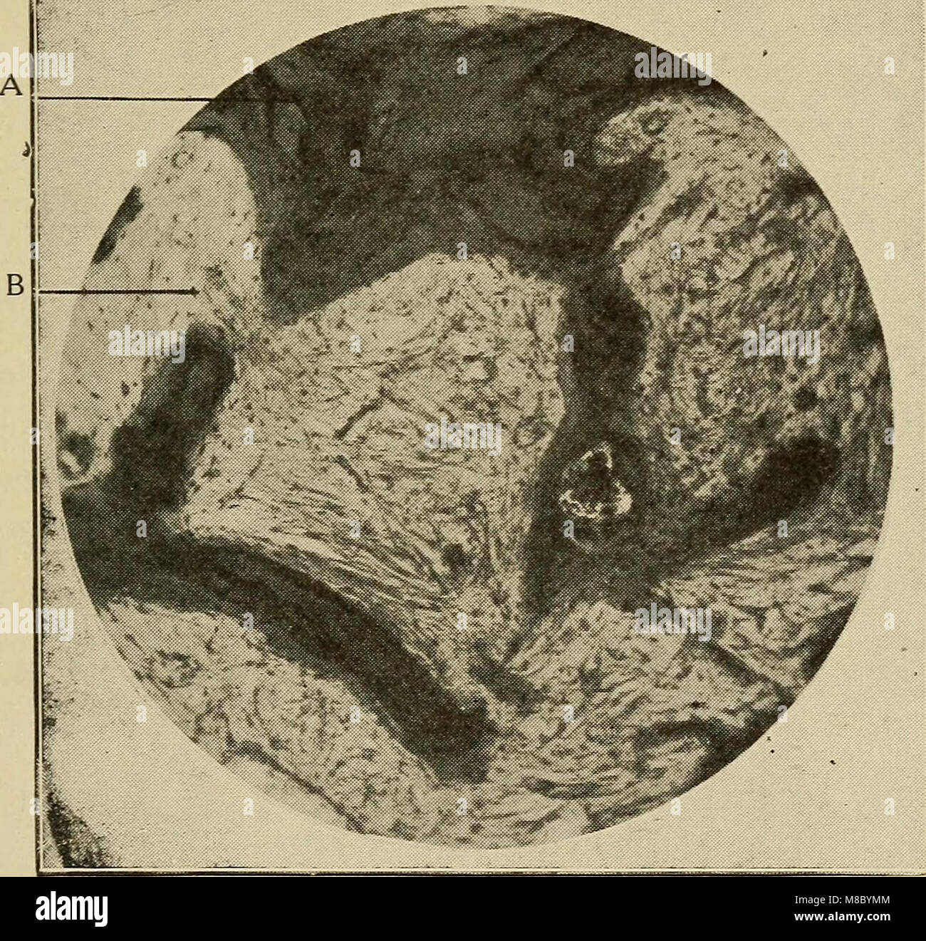 Diseases of Bones and Joints (1914) addresses medical conditions ...