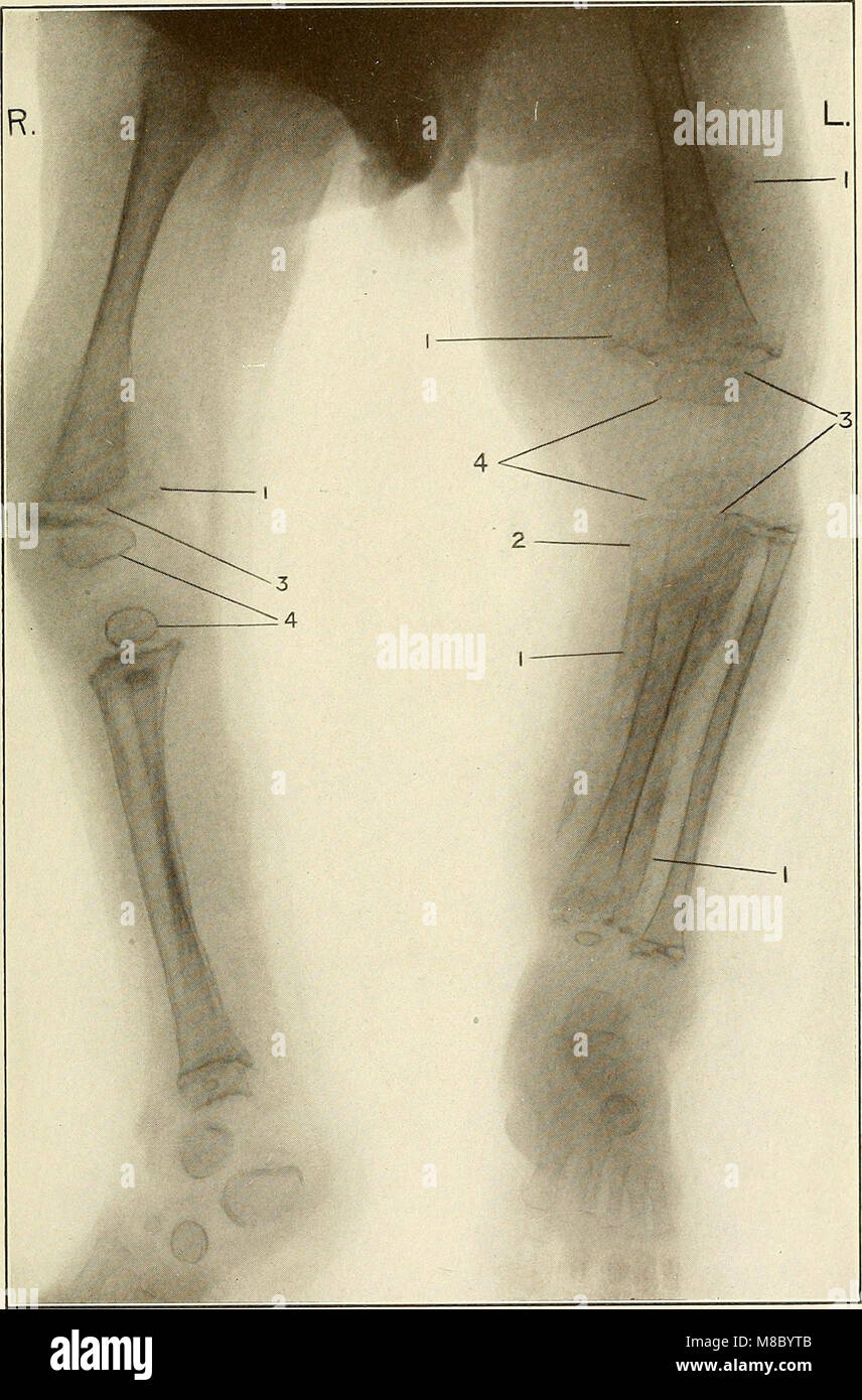This book provides a comprehensive look at various diseases affecting ...
