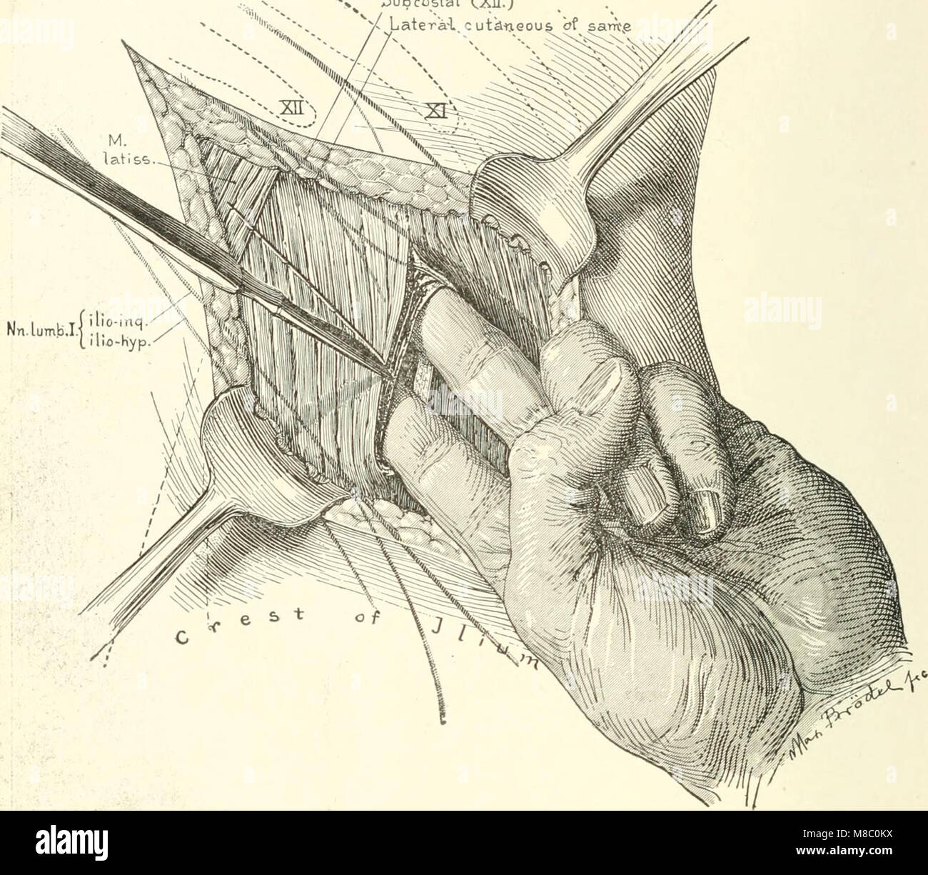 Diseases of the kidneys, ureters and bladder, with special reference to ...