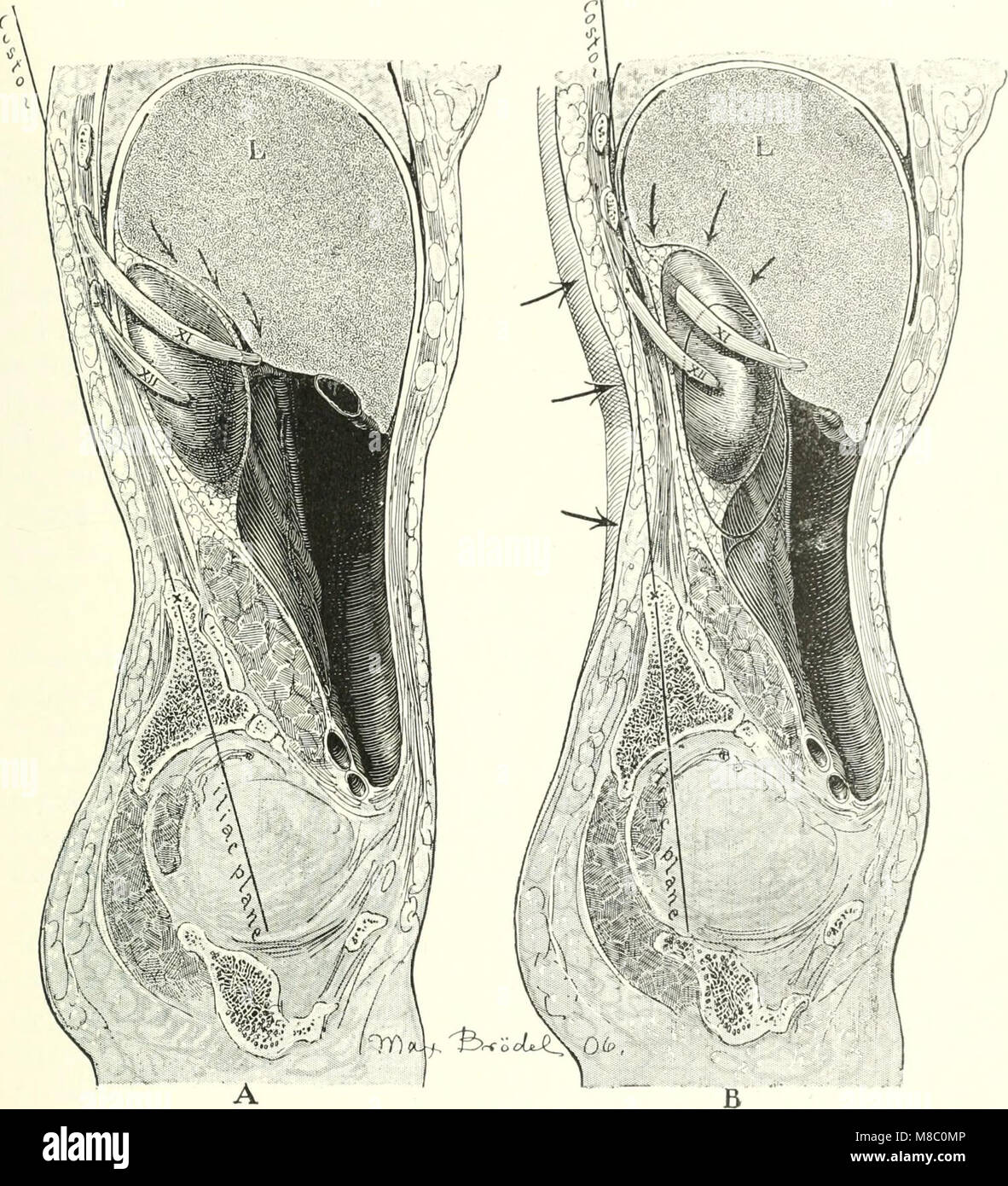 Diseases of the kidneys, ureters and bladder, with special reference to ...