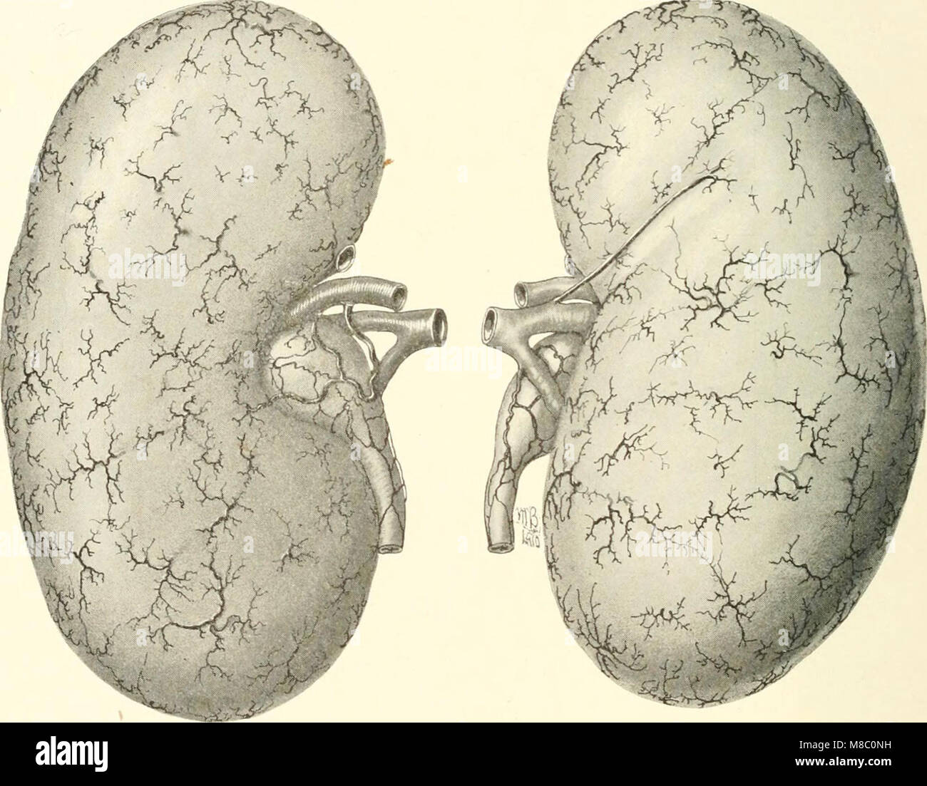 This 1922 medical text focuses on the diseases of the kidneys, ureters ...