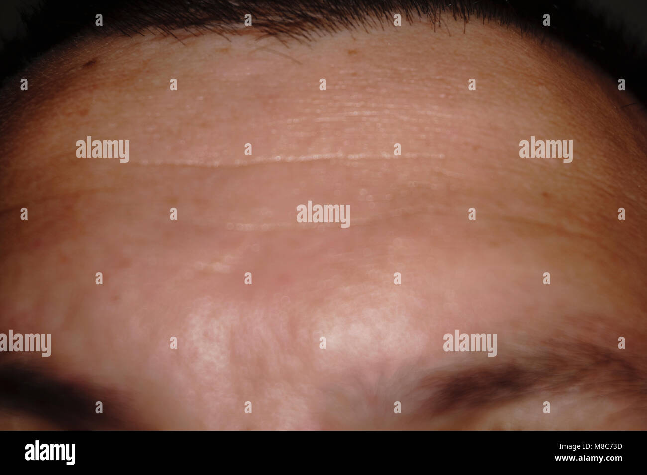 Men's forehead wrinkles and grey eyebrows Stock Photo - Alamy Men's forehead wrinkles and grey eyebrows Stock Photo - Alamy