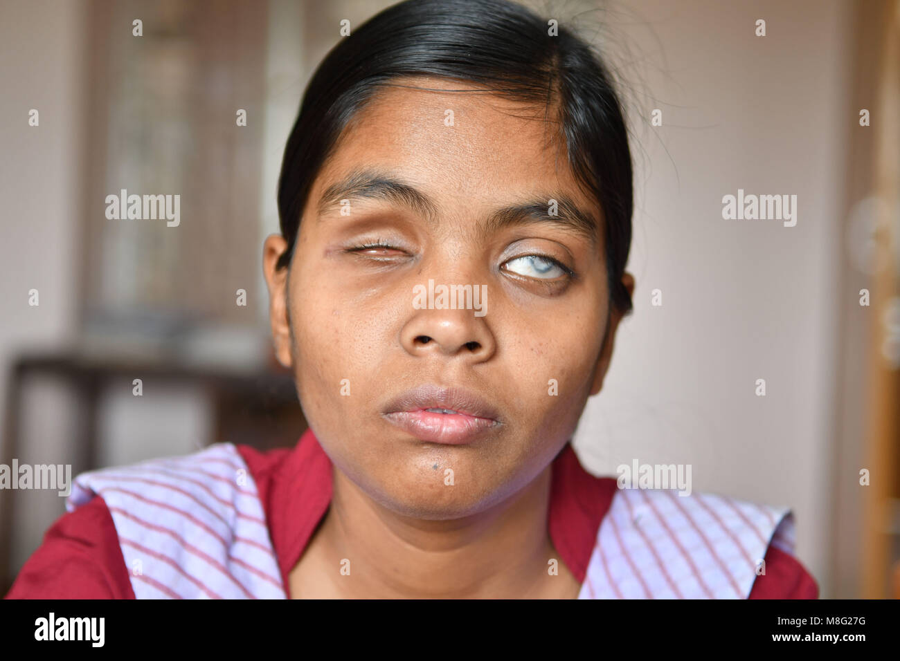 Blind girls hi-res stock photography and images - Alamy