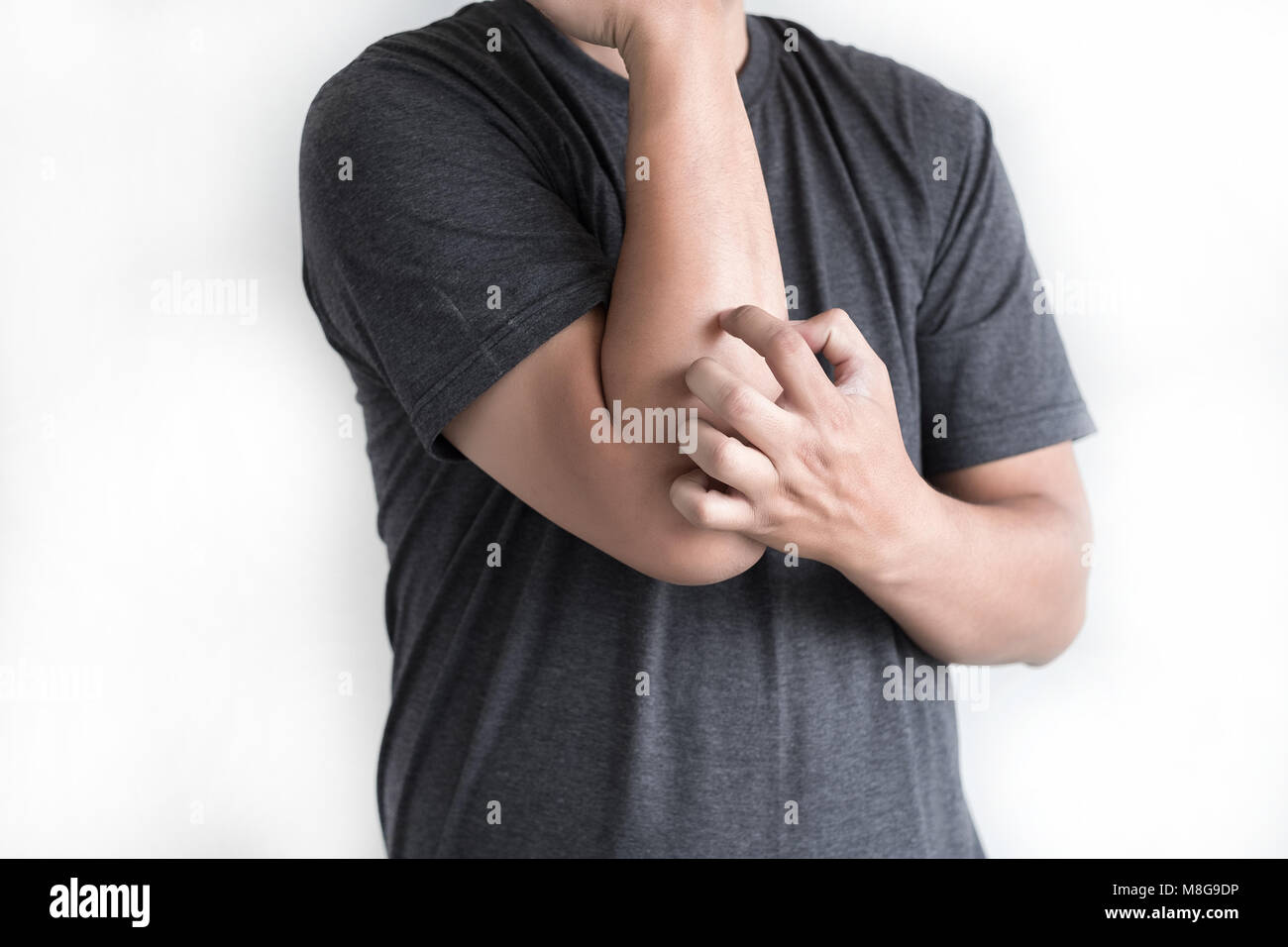 Scratching Arm Stock Photos & Scratching Arm Stock Images - Alamy