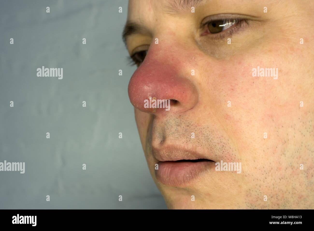 man with a problem and pain in the head Stock Photo - Alamy