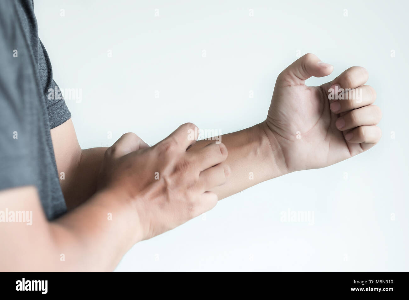 itchy arms scratching Healthcare And Medicine Health problem Stock ...