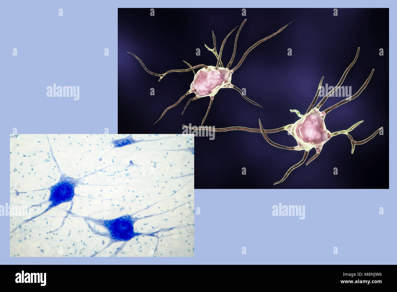 Nerve cells. Computer illustration and light micrograph of nerve cells ...