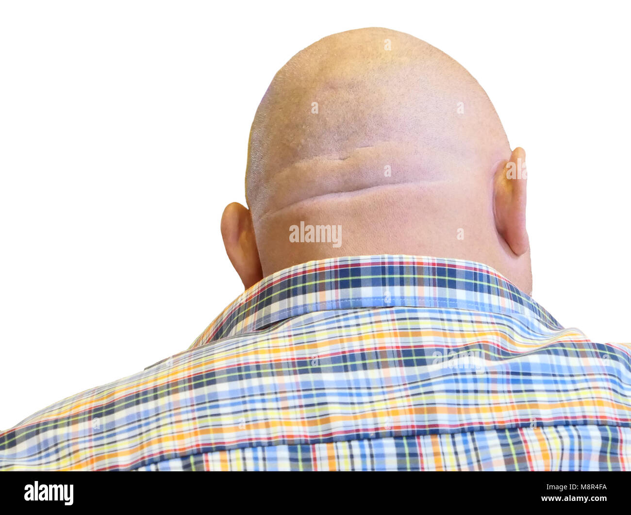 Bald head isolated on white background Stock Photo - Alamy