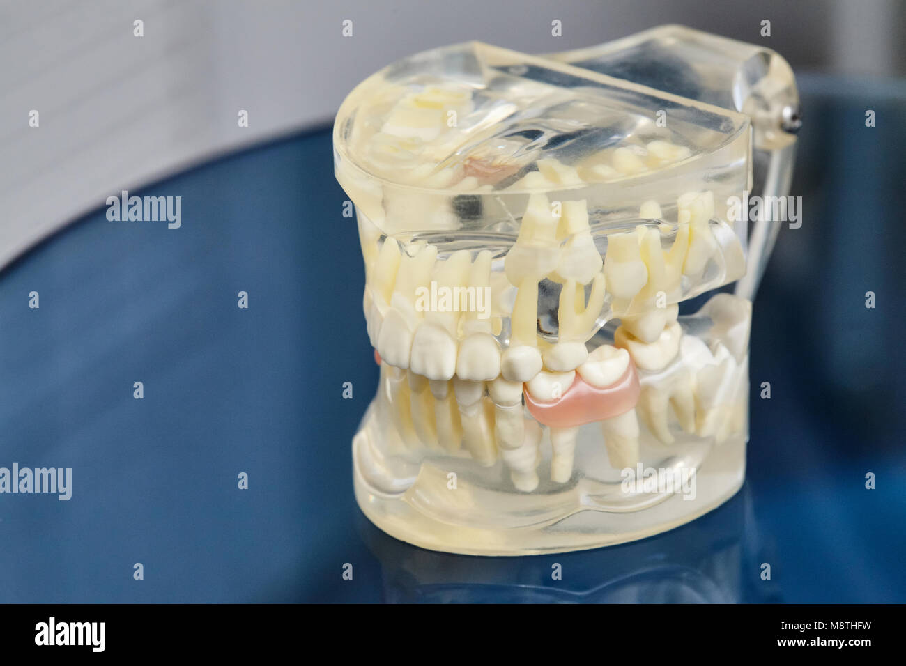 Human jaw or teeth orthodontic dental model, closeup Stock Photo - Alamy