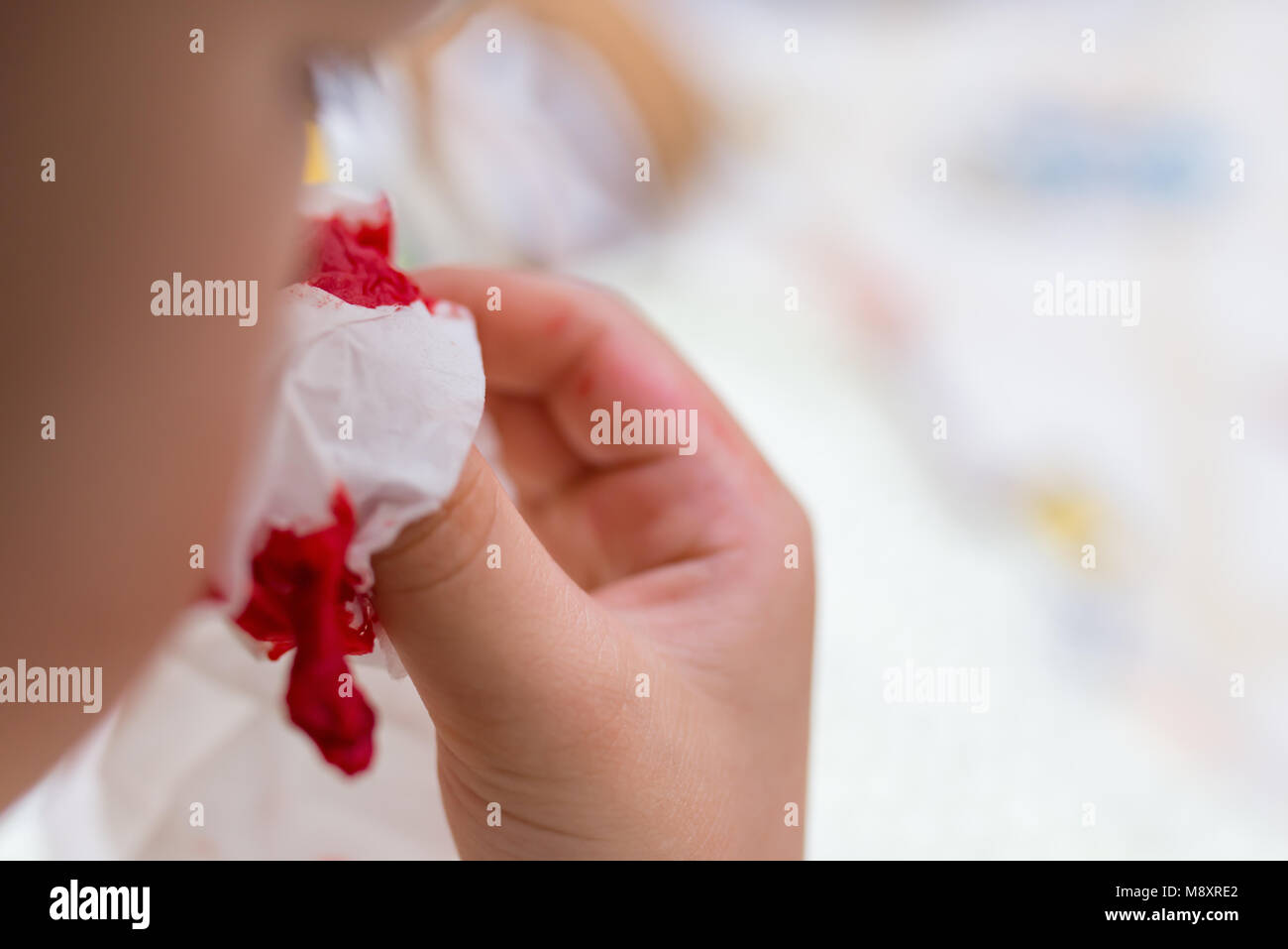 Boy with blood nose hi-res stock photography and images - Alamy