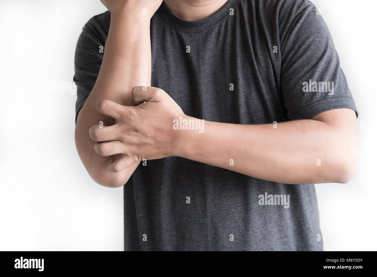 Scratching Arm Stock Photos & Scratching Arm Stock Images - Alamy