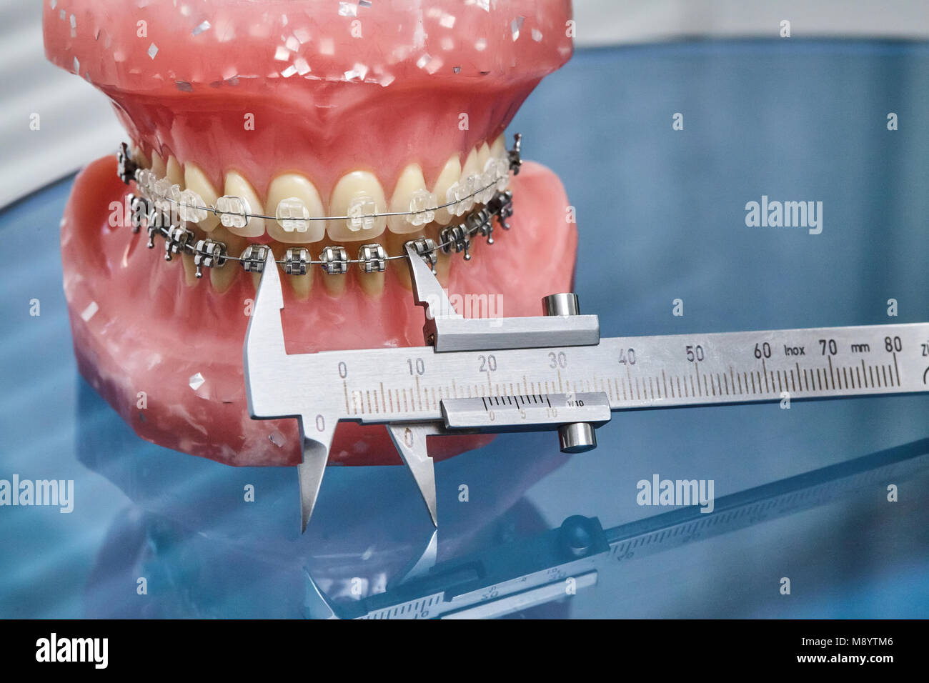 Human jaw or teeth model with metal wired dental braces and vernier ...
