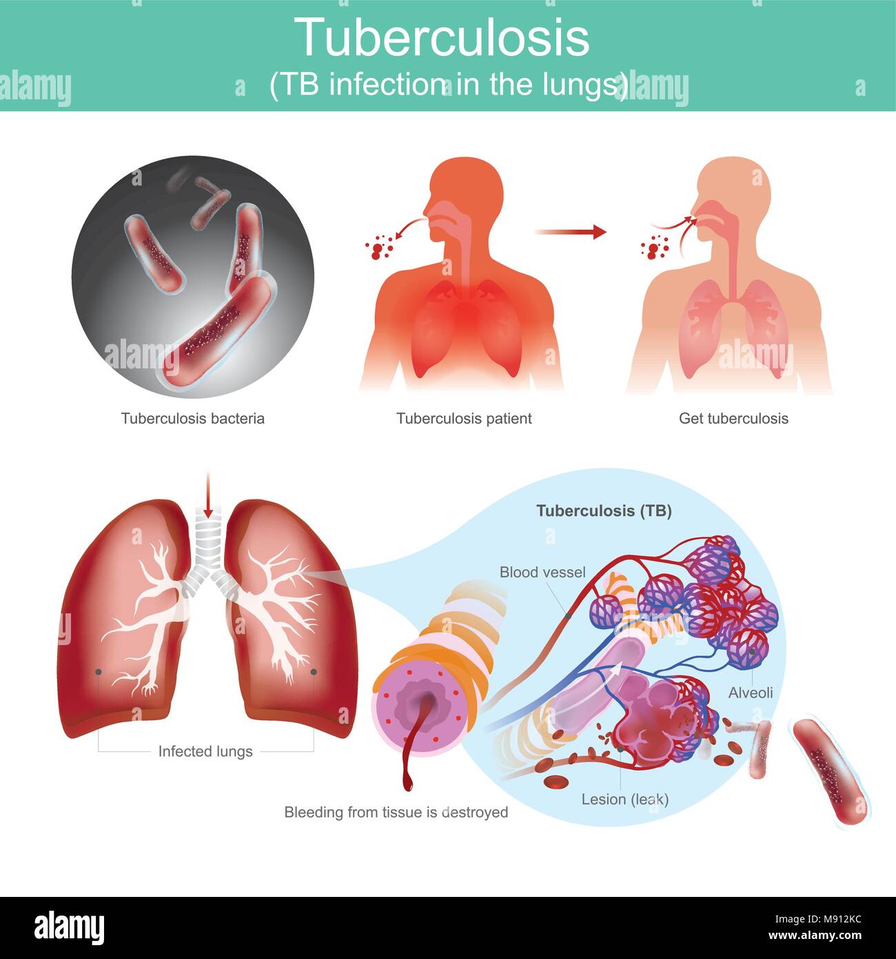 Blood arch Stock Vector Images - Alamy