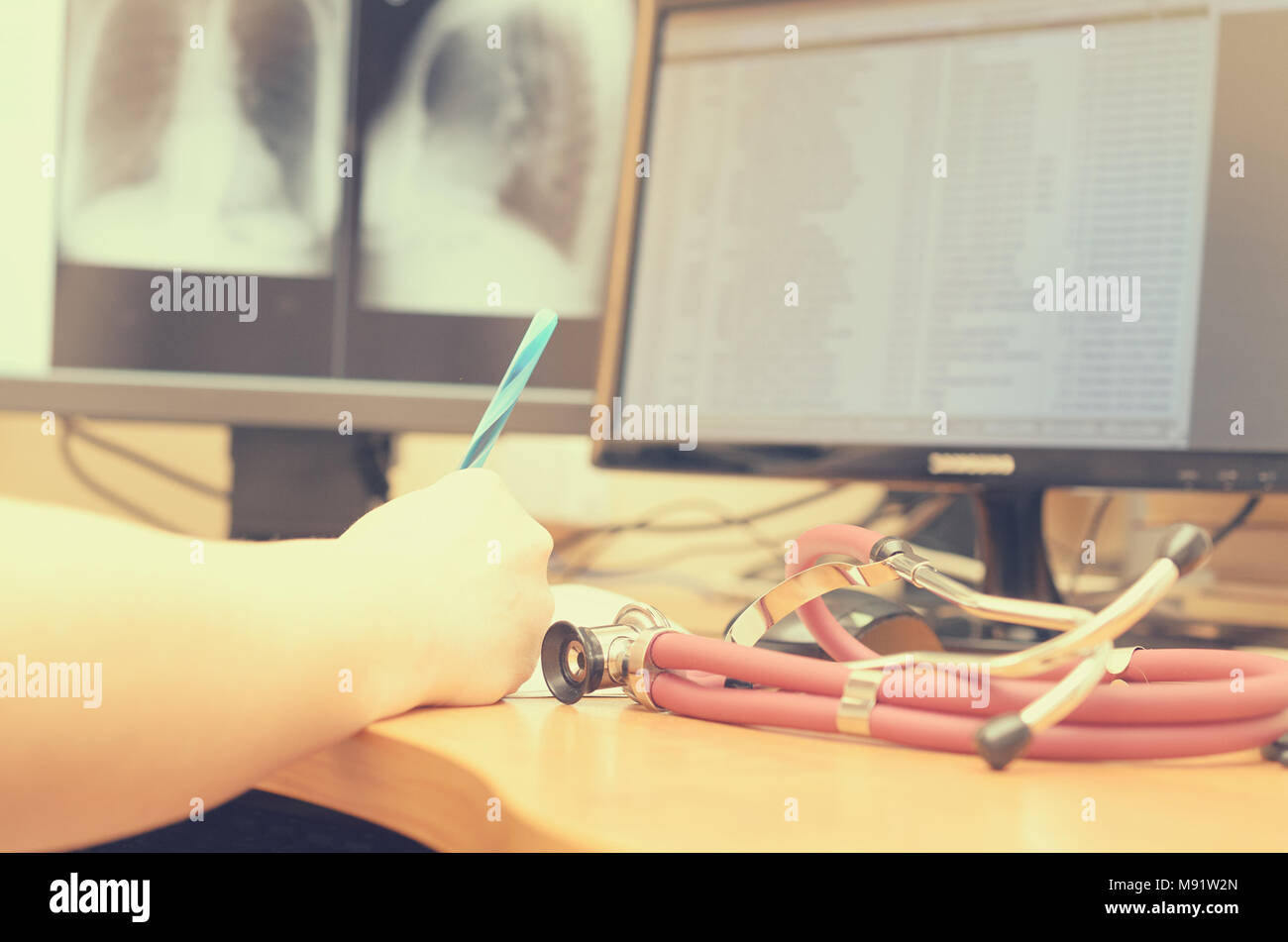 Medical radiograph hi-res stock photography and images - Alamy