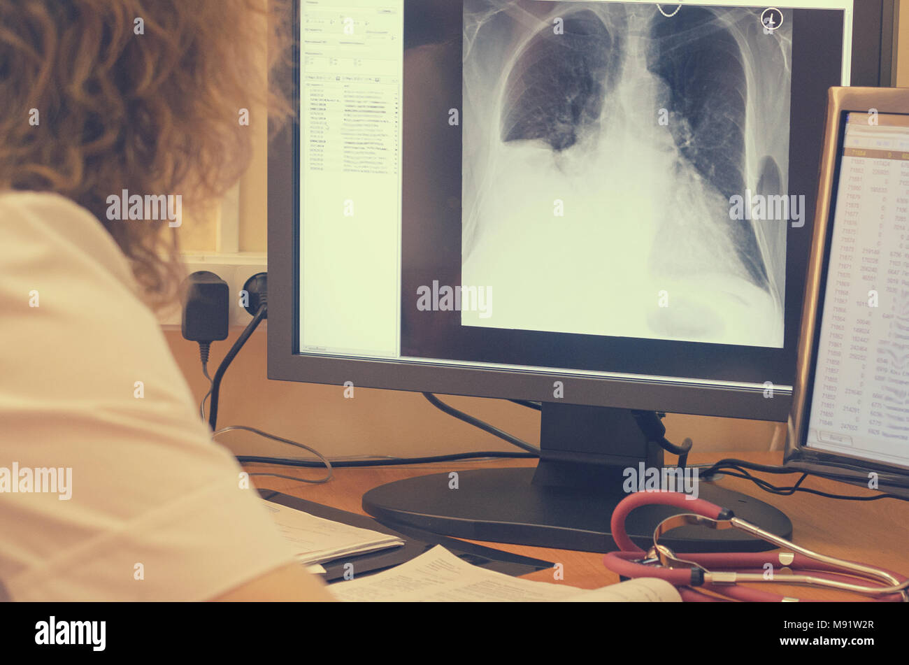 The radiologist looks at the x-ray images on a computer monitor Stock ...