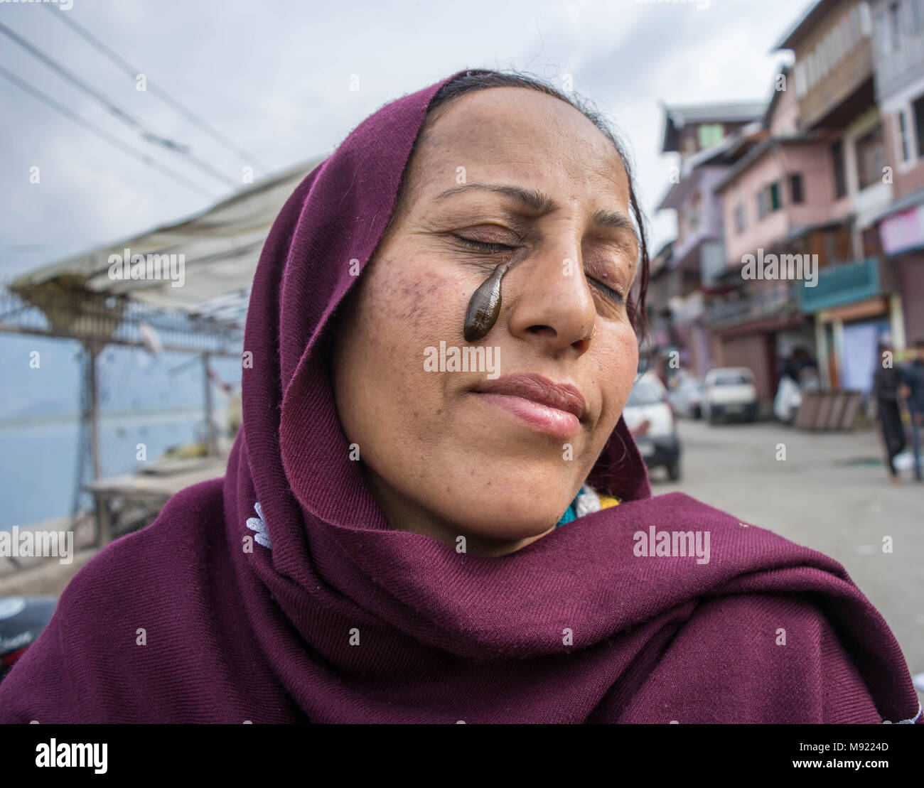 The leech woman hi-res stock photography and images - Alamy
