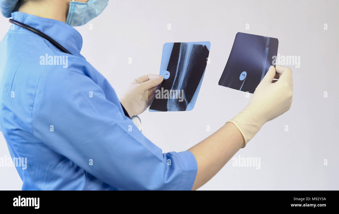 Doctor analyzing injured bones x-ray, making diagnosis, hospital ...