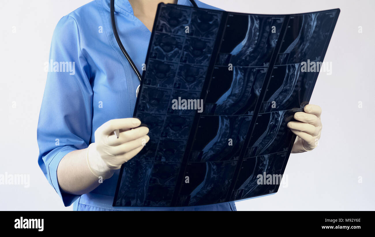 Professional surgeon looking on neck x-ray, making diagnosis, treating ...