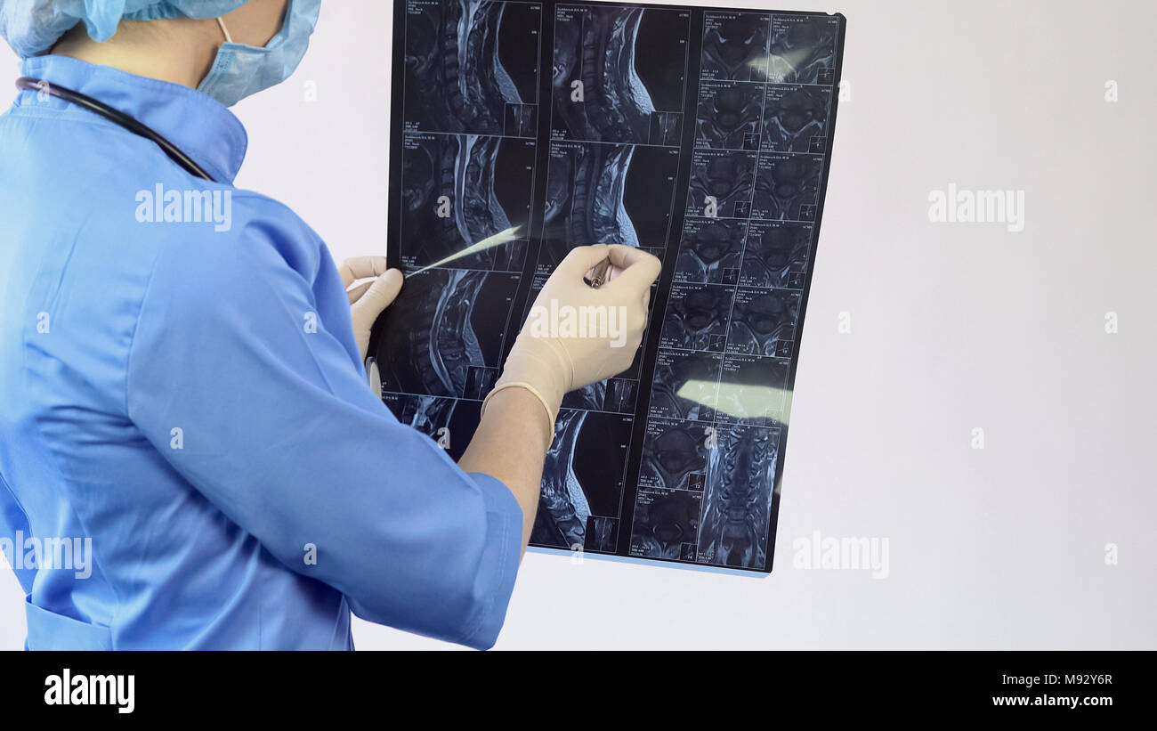 Female doctor analyzing patient spine bones x-ray, back pain treatment ...