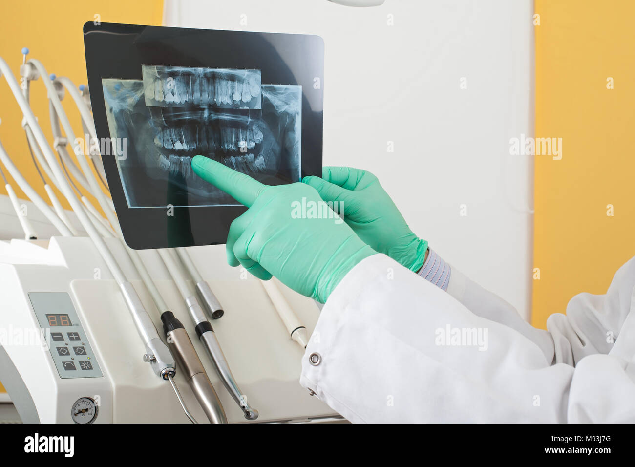Close up picture of male dentist examining patient's dental panoramic ...