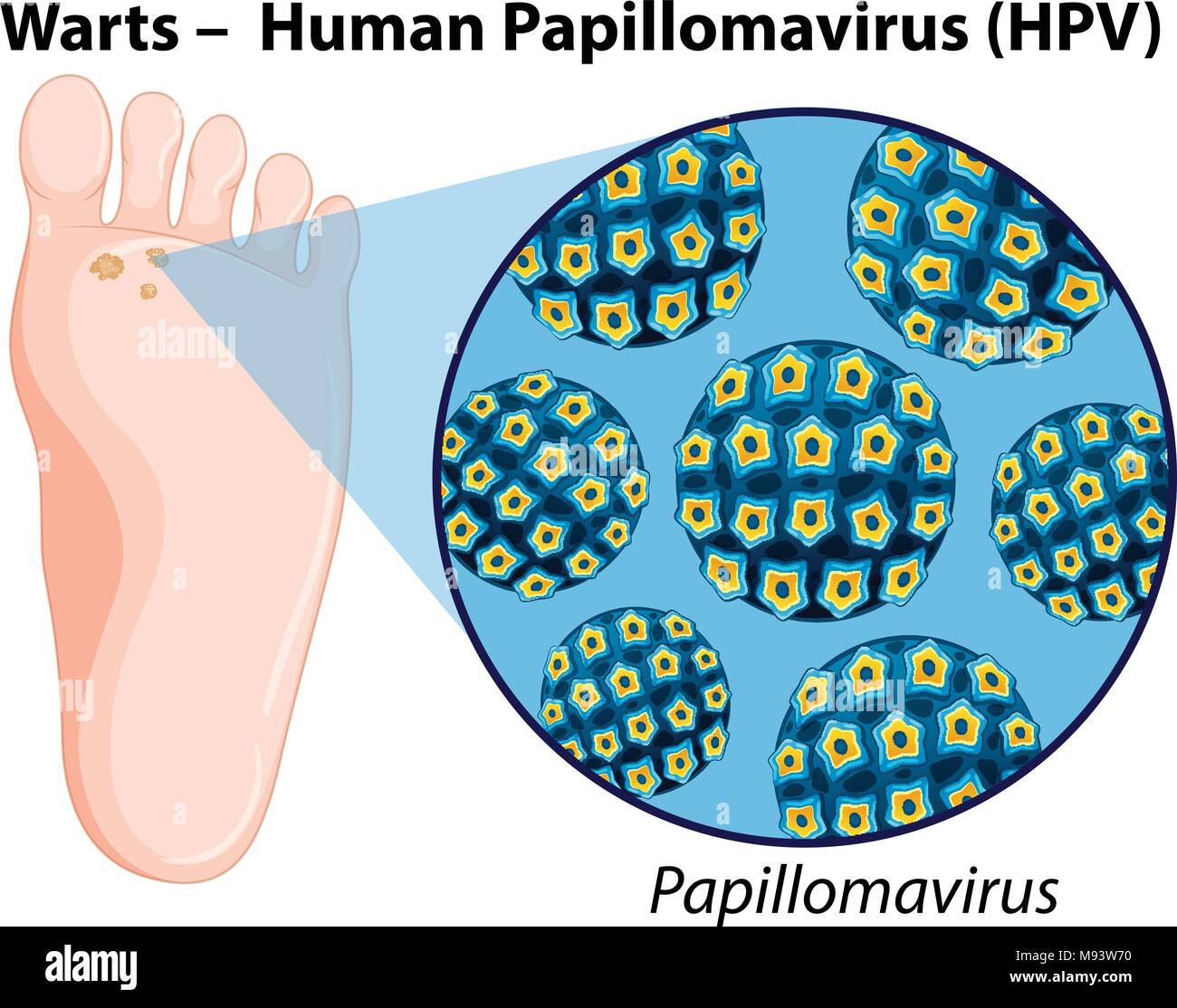 Human papillomavirus hi-res stock photography and images - Alamy