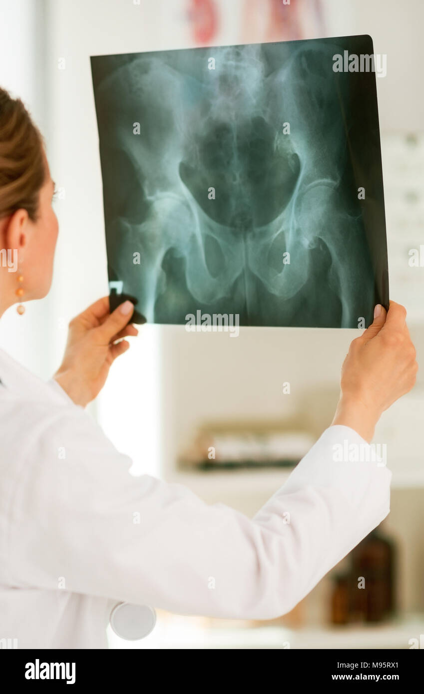 Doctor woman looking on fluorography. rear view Stock Photo - Alamy