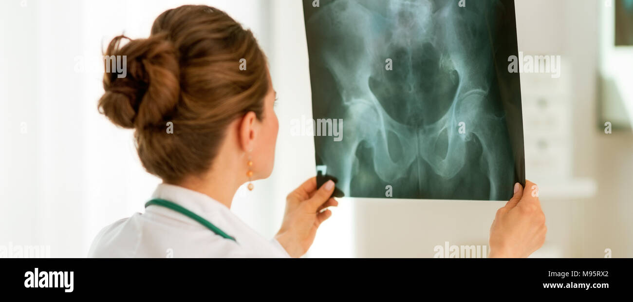 Doctor woman looking on fluorography. rear view Stock Photo - Alamy