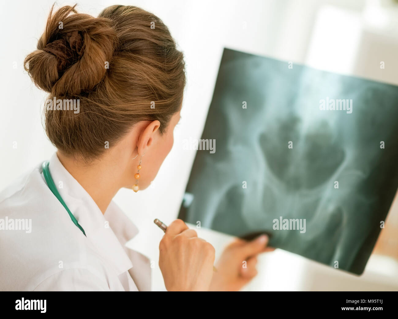 Medical doctor woman looking on fluorography. rear view Stock Photo - Alamy