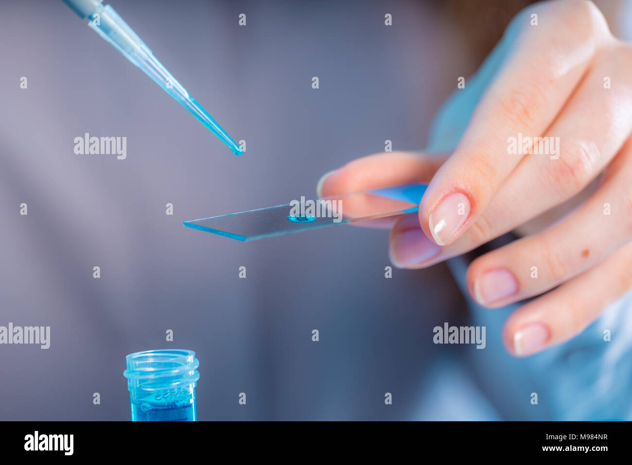 Blood sample on microscope slide. Researcher Analyzing Microscope Slide ...
