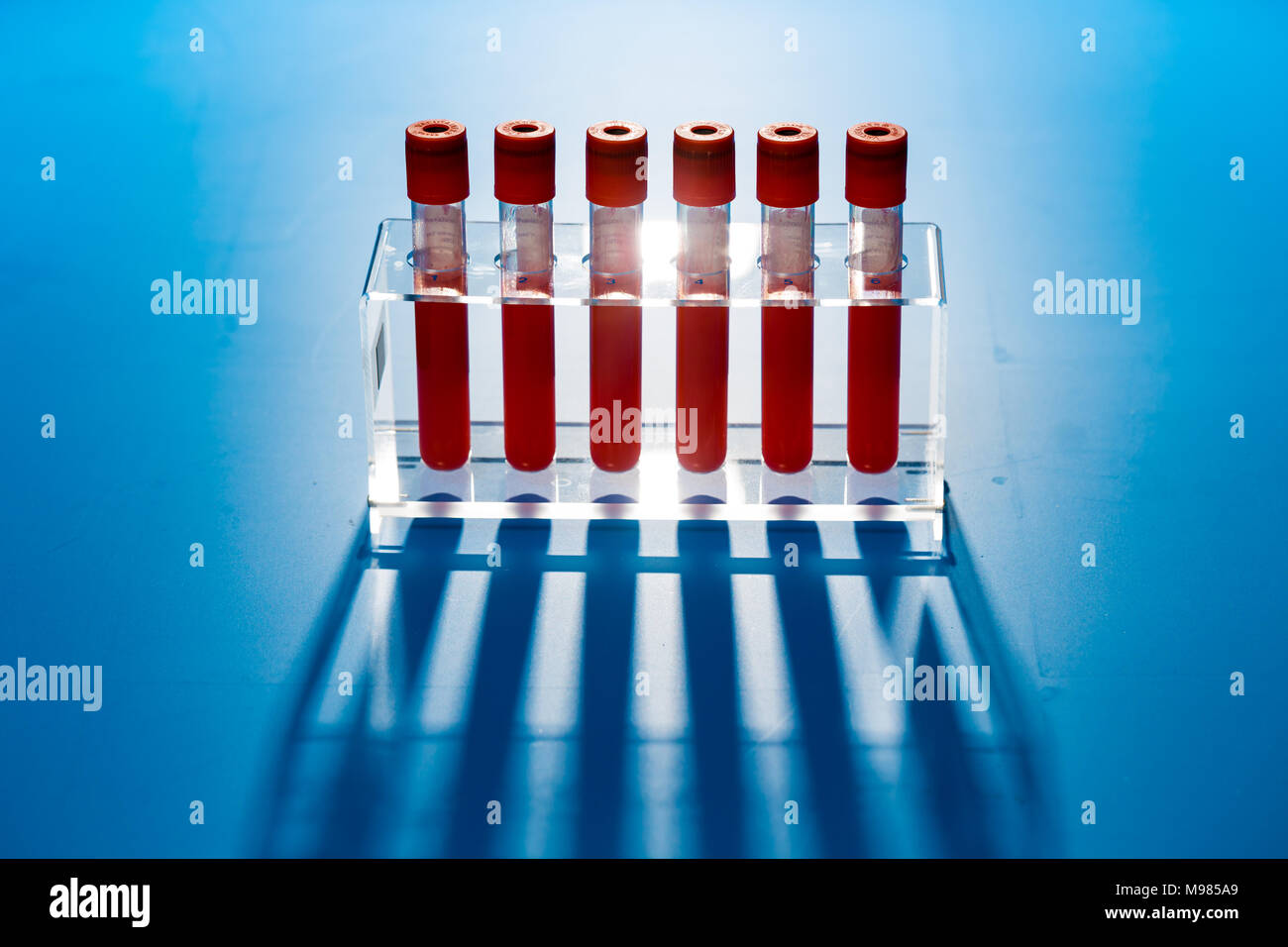 Test tubes with blood for medical and biological analyzes Stock Photo ...