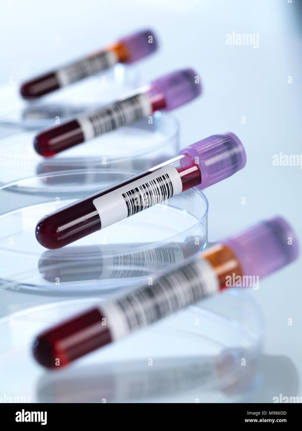 Blood samples in petri dishes Stock Photo - Alamy