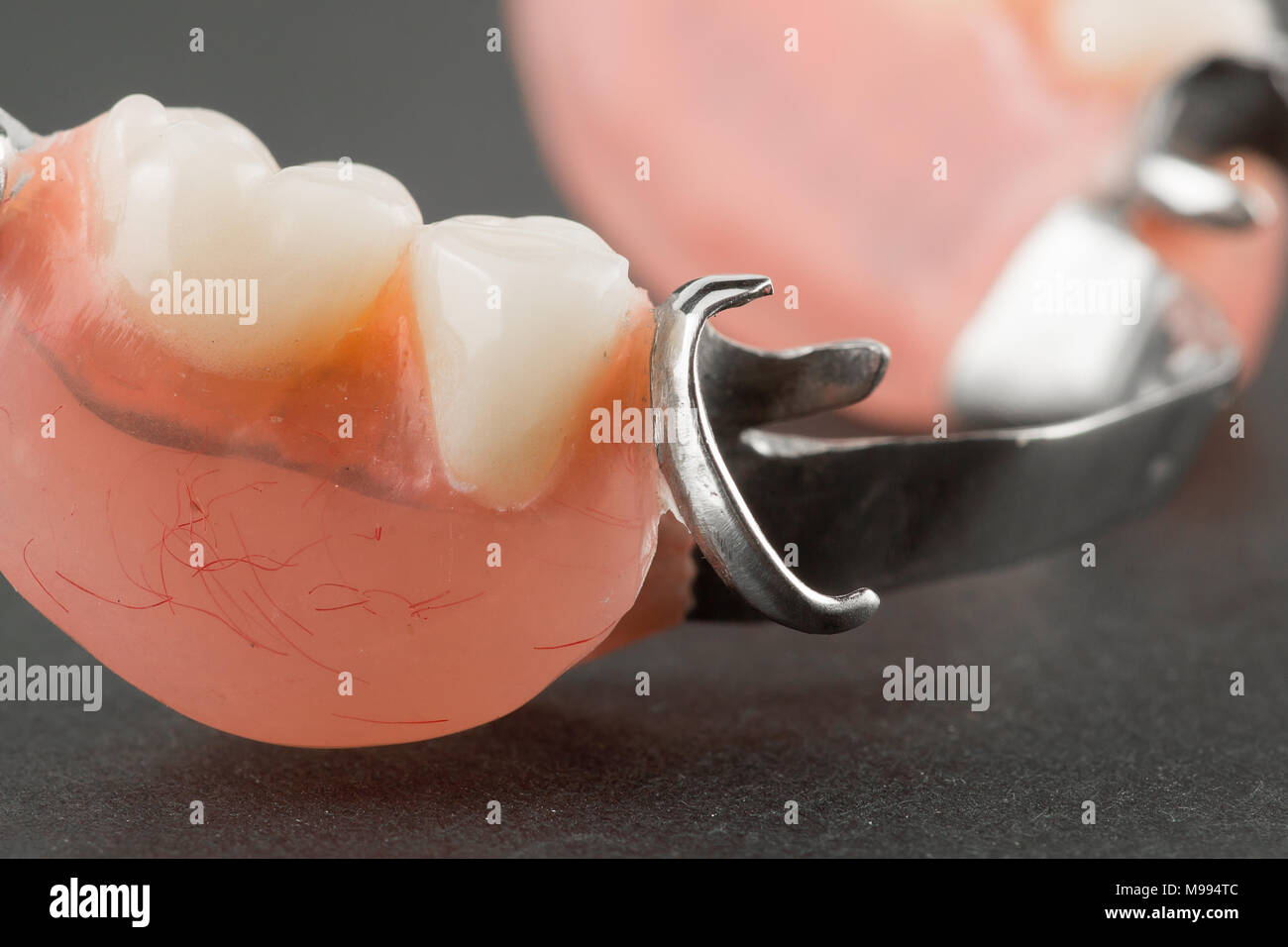Elements of a clasp prosthesis close-up isolated on a black background ...
