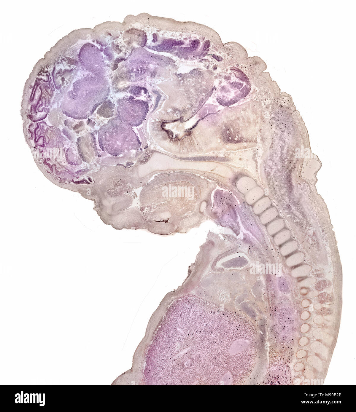 Four week old human embryo slide section, longitudinal section head ...