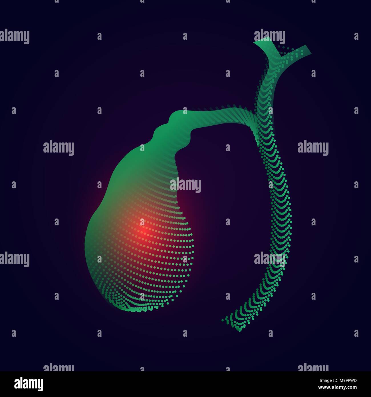 Gallbladder with a point of pain. Stylized transition from a real organ ...