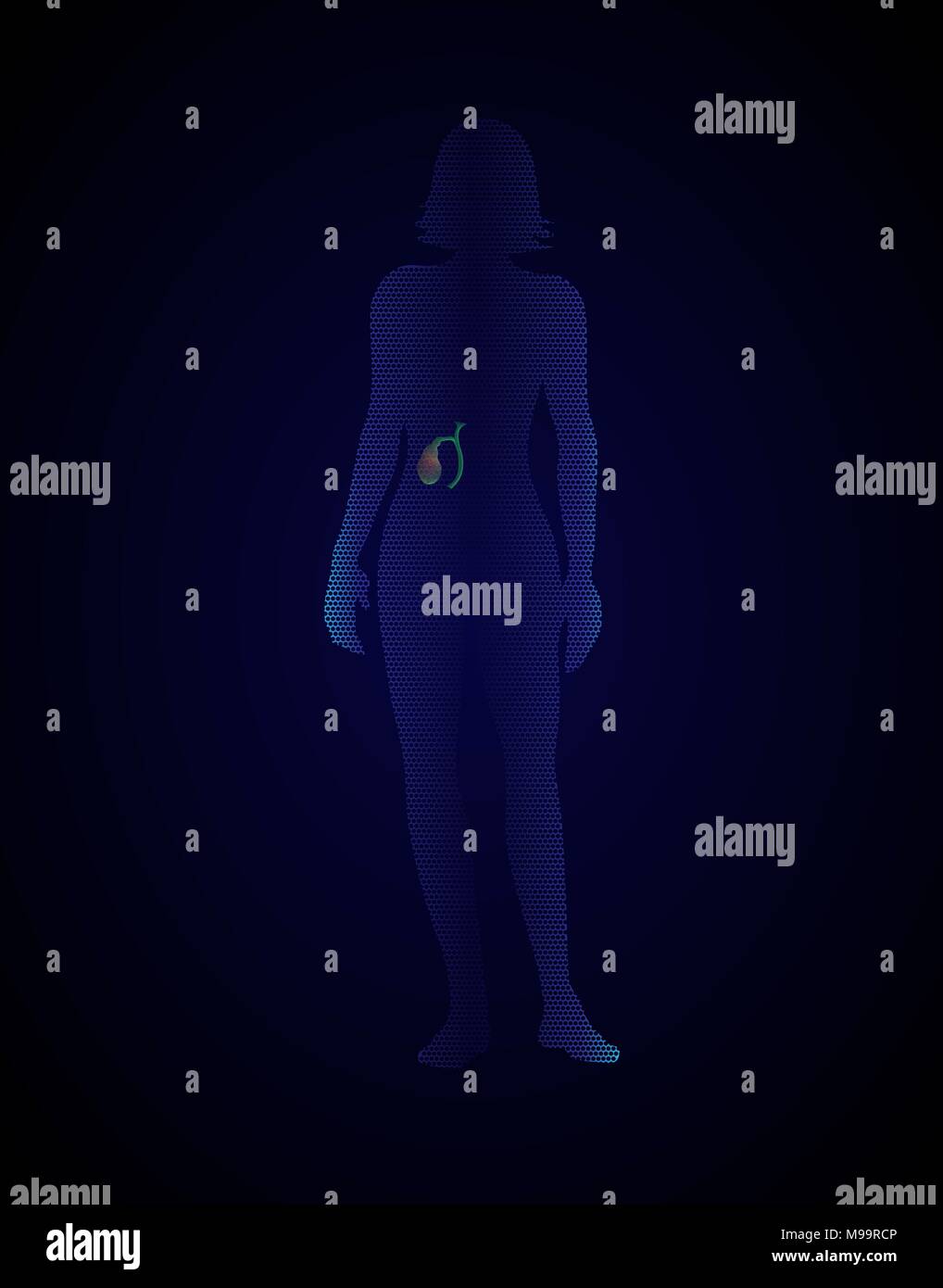 Vector x ray gallbladder infographics. silhouette of a woman with a ...