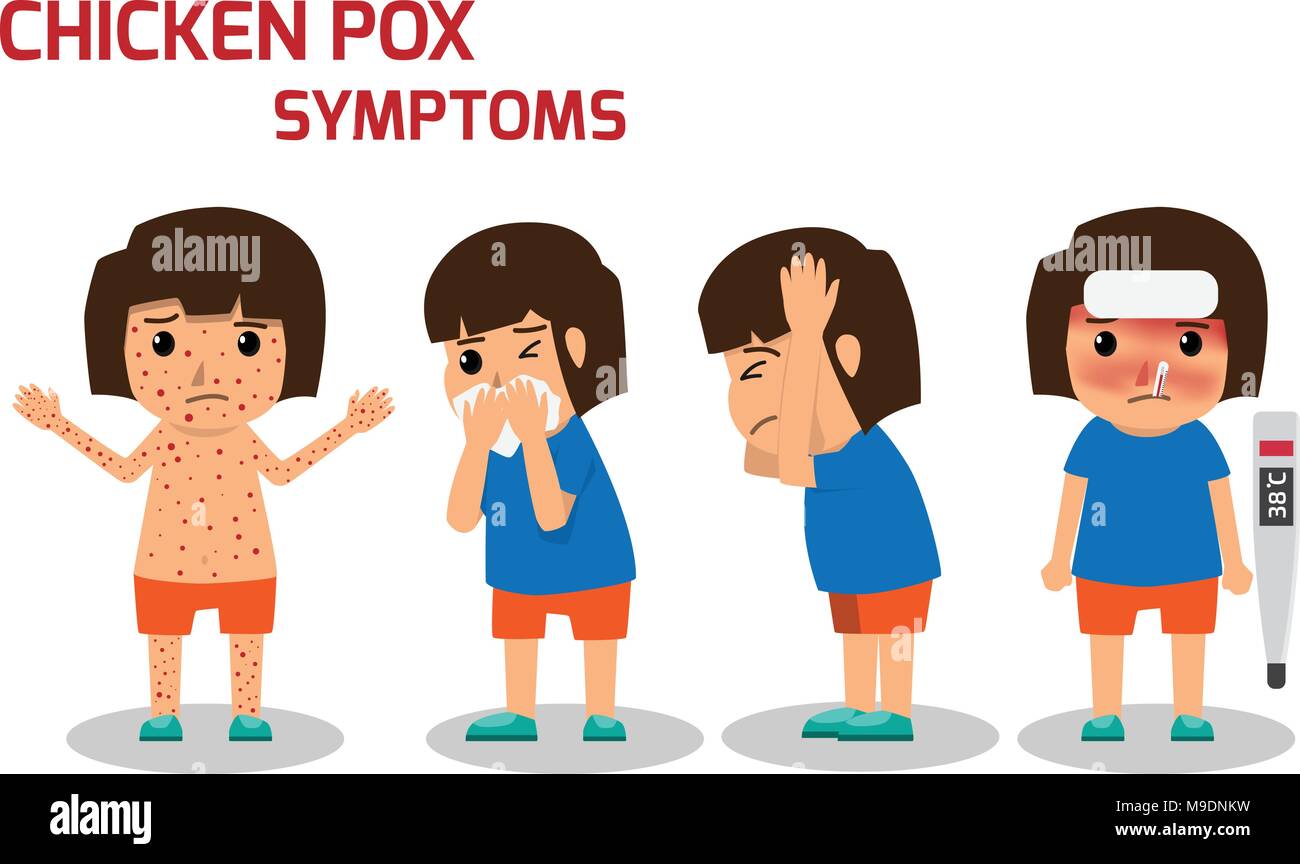Children has chicken pox infographic, Poster children fever and ...